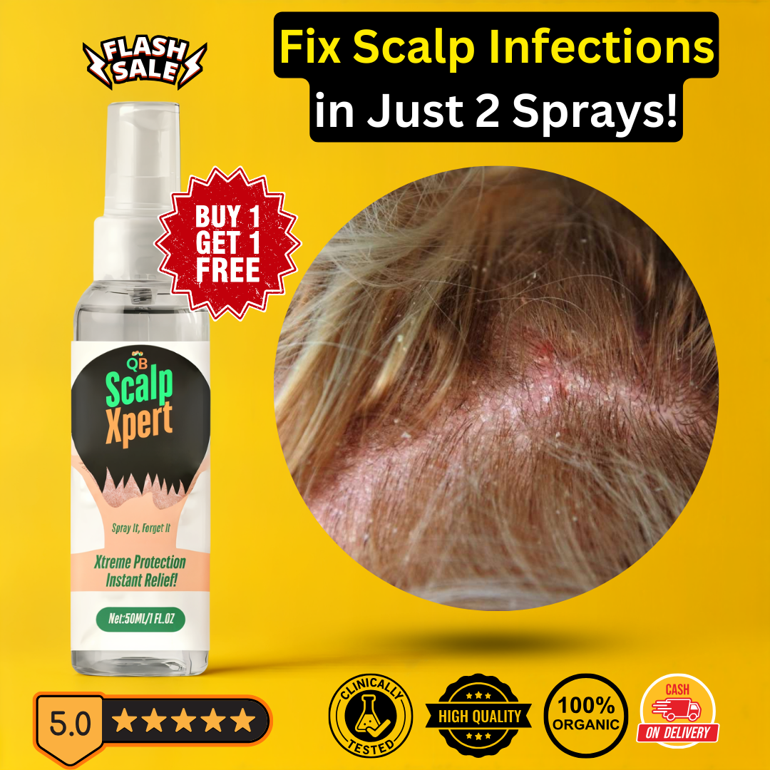 ScalpXpert Anti Fungal Scalp Spray - Buy 1 Get 1 Free🔥🔥 – PazzLify