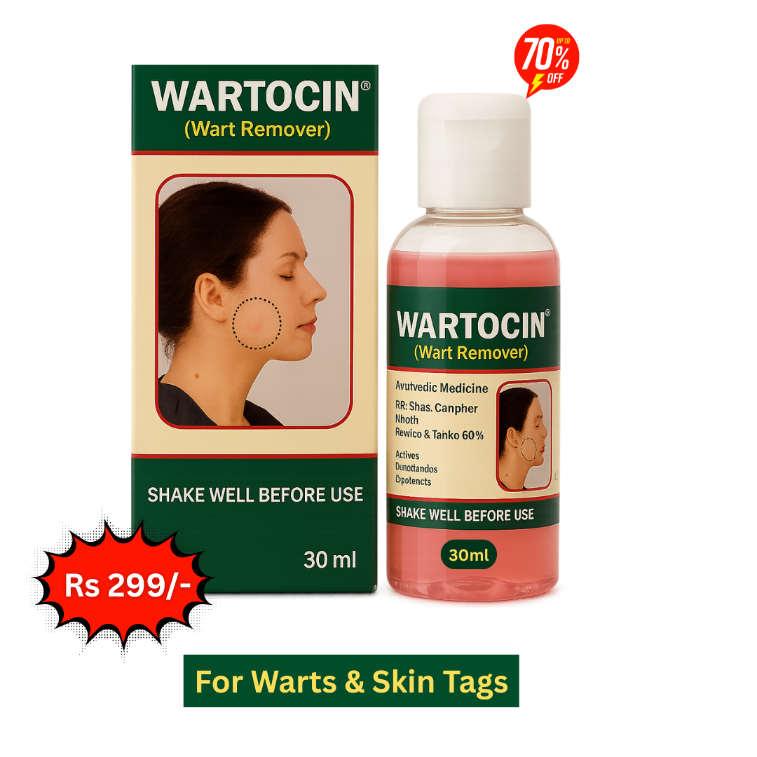 Wartocin Wart & Skin Tag Remover - 30ml – PazzLify